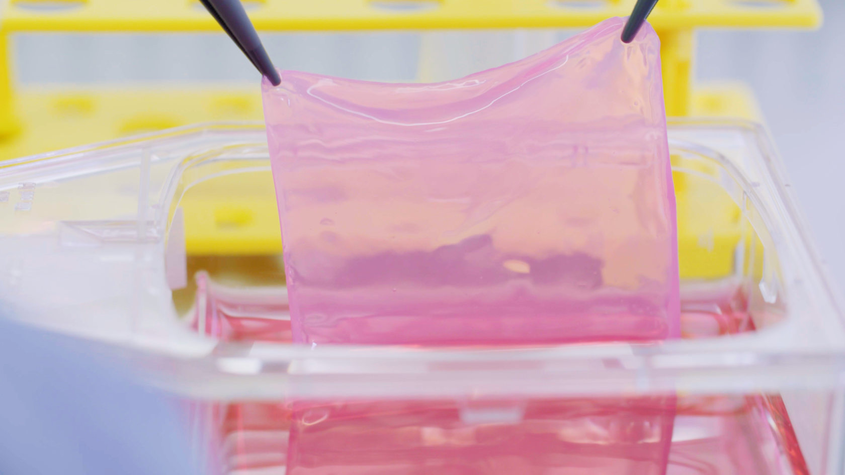 New Skin for Burn Victims | | UZH